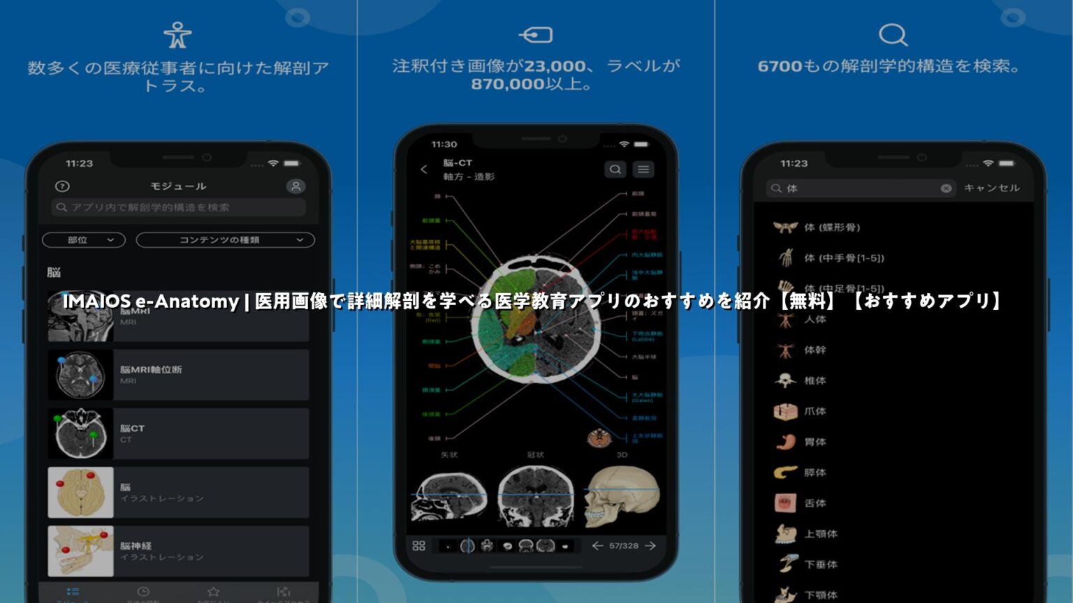 IMAIOS e-Anatomy | 医用画像で詳細解剖を学べる医学教育アプリのおすすめを紹介【無料】【おすすめアプリ】 | AppMatch